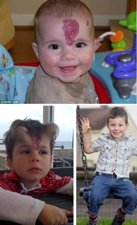 10 Of The Strangest Birthmarks Ever Recorded. | ThatViralFeed