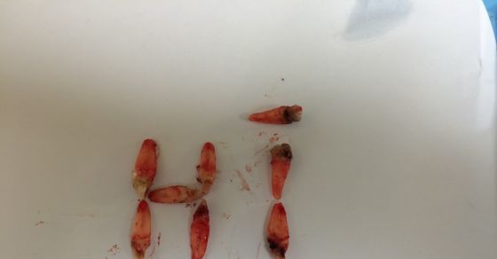 13 Photos That Scream NOPE At The Top Of Their Lungs | ThatViralFeed