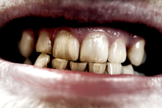 Really Gross Facts About Your Teeth | ThatViralFeed