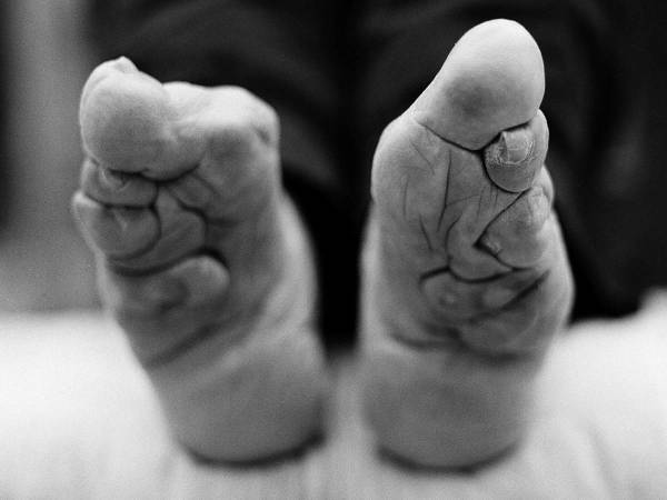 The Most Extreme Body Modifications Throughout History | ThatViralFeed