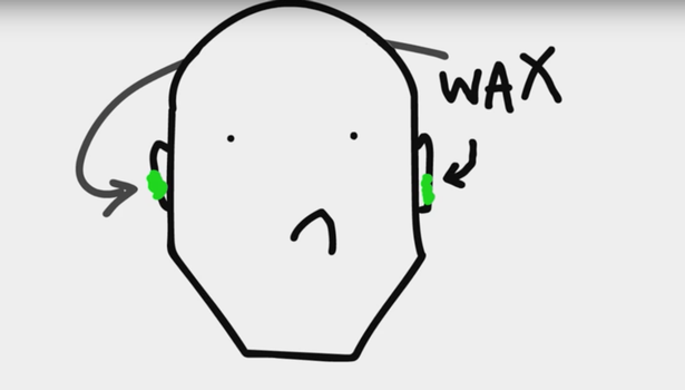Bizarre Video Shows How EAR WAX Is Made And Why - And It Will Really ...