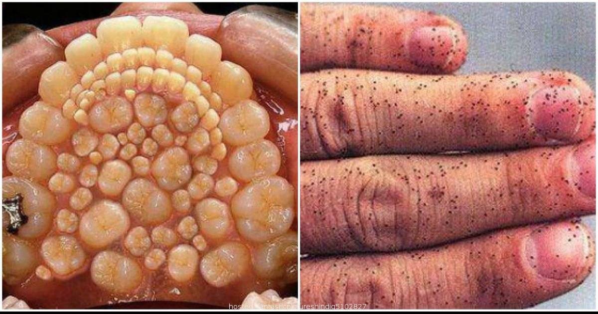 10 Most Disgusting Pictures You Will Ever See On The Internet | ThatViralFeed