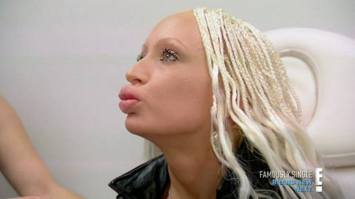 Terrifying Lip Filler Fails | ThatViralFeed