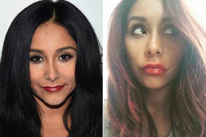 Terrifying Lip Filler Fails | ThatViralFeed