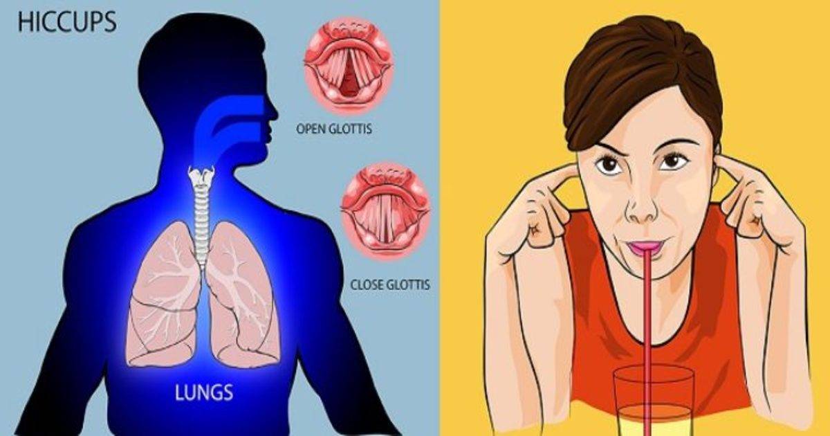 8 Super Easy Ways To Stop Your Hiccups | ThatViralFeed