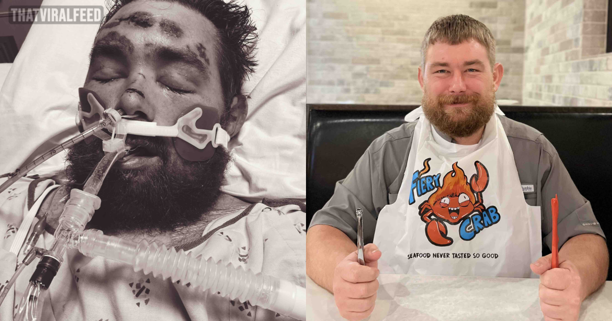 Man Left In Coma And Given 4% Chance Of Survival After Pulling Out ...