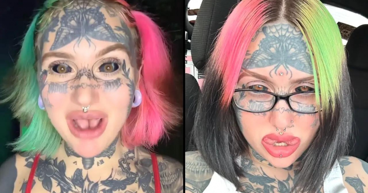 Woman Who Spent $70k On Extreme Makeover Reveals Shocking Before Photos ...